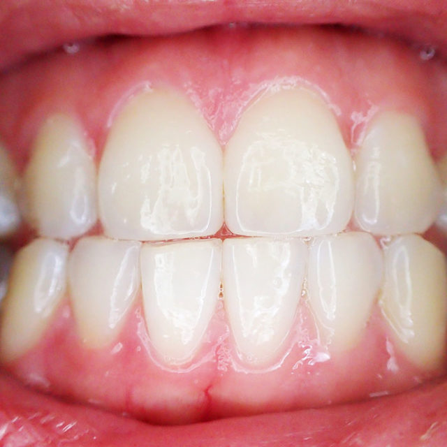 A Closer Look at Teeth - Carolina Oral : Carolina Oral